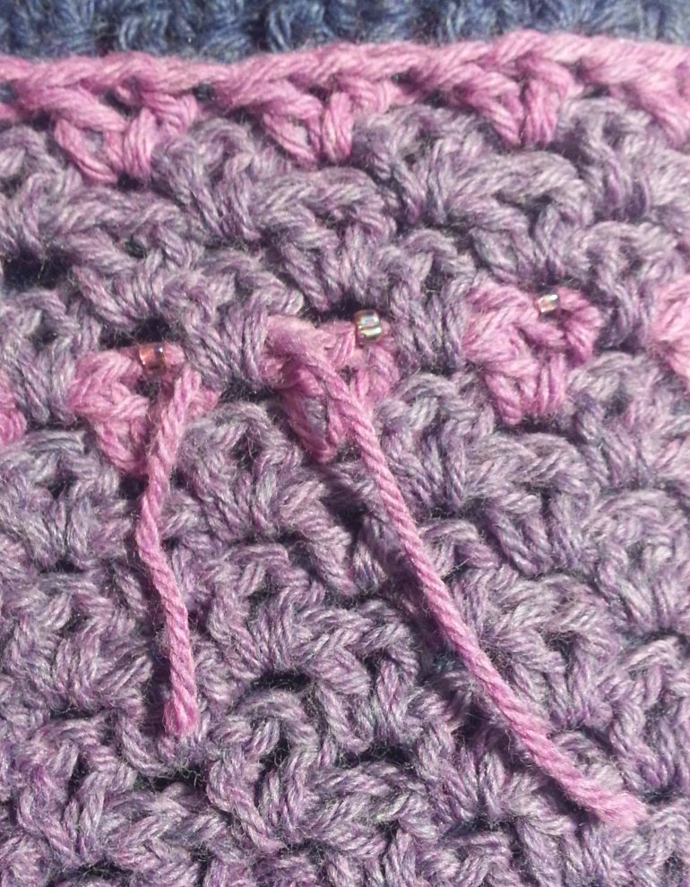 Some Crochet Surgery Mamas2hands 2236